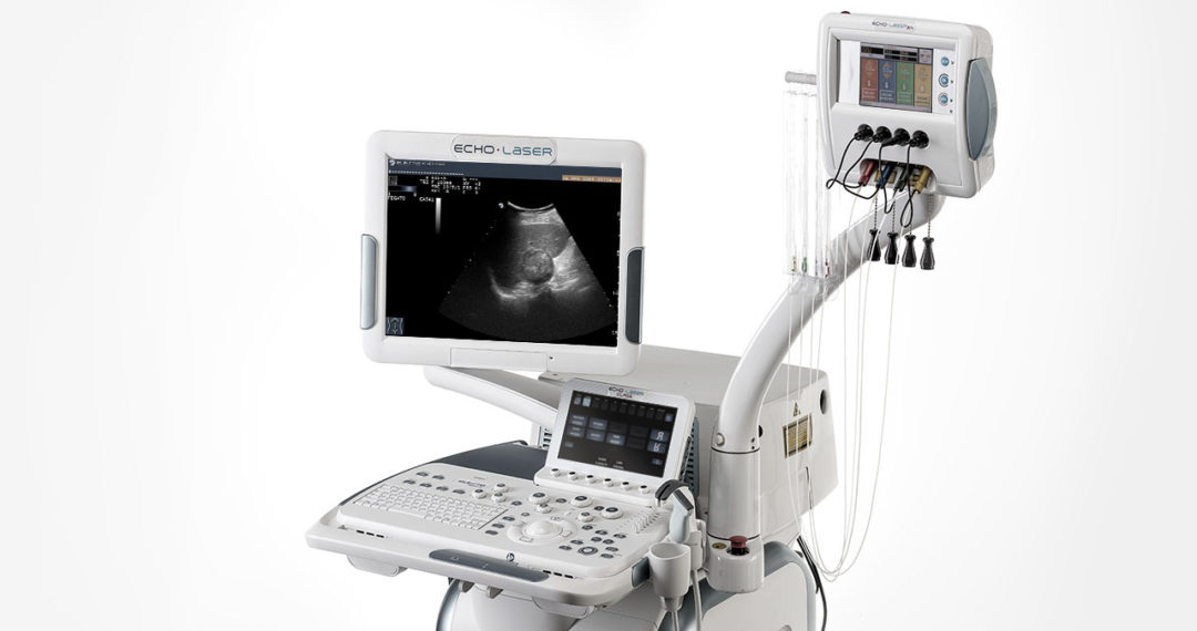 EchoLaser | Elesta Echolaser